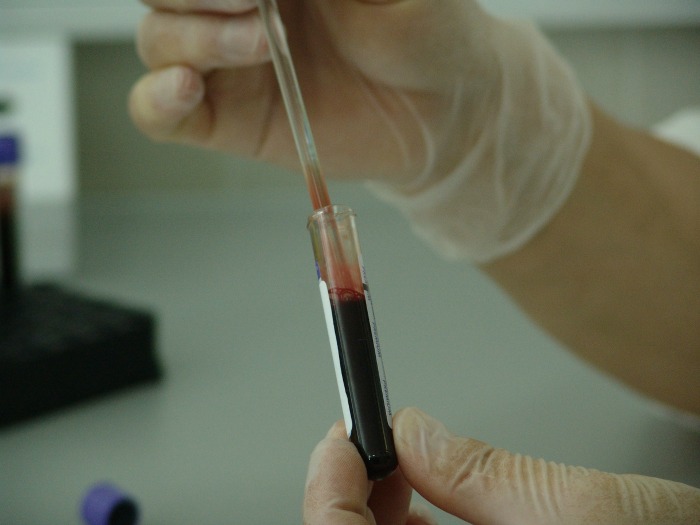 The Top Health Tests For Over 60s This Year Starts At 60